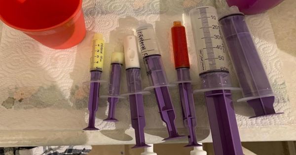 Firefly United States | Types of tube feeding